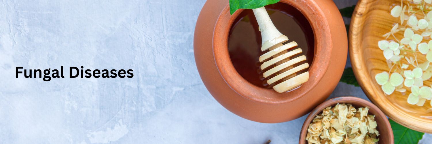 Best Fungal Infections Treatment in Delhi | SKK Ayurveda